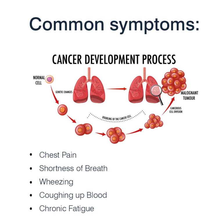 Lung Cancer Symptoms Types And Treatments